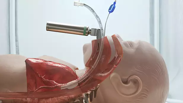 Proper Ventilation Procedures During Respiratory Care