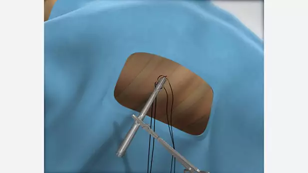Intercostal Drain Insertion (Mattress Suture Technique)
