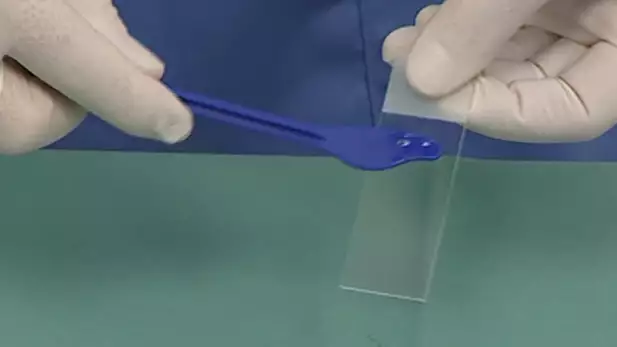 Cervical Smear for Medical Professionals