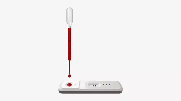 Perform Rapid Infectious Mononucleosis Test